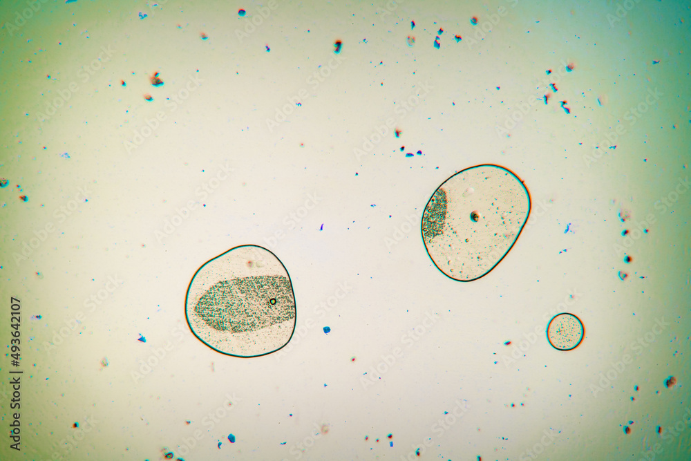 Biological fluid at a crime scene under a microscope as evidence of a ...