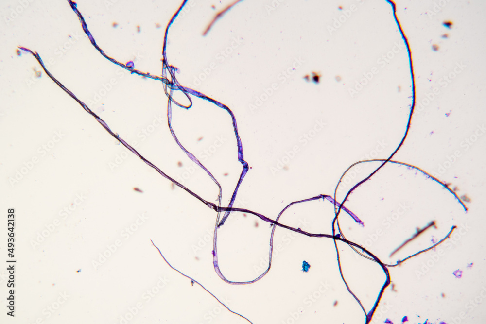 Tissue fibers from the crime scene under a microscope. Physical ...