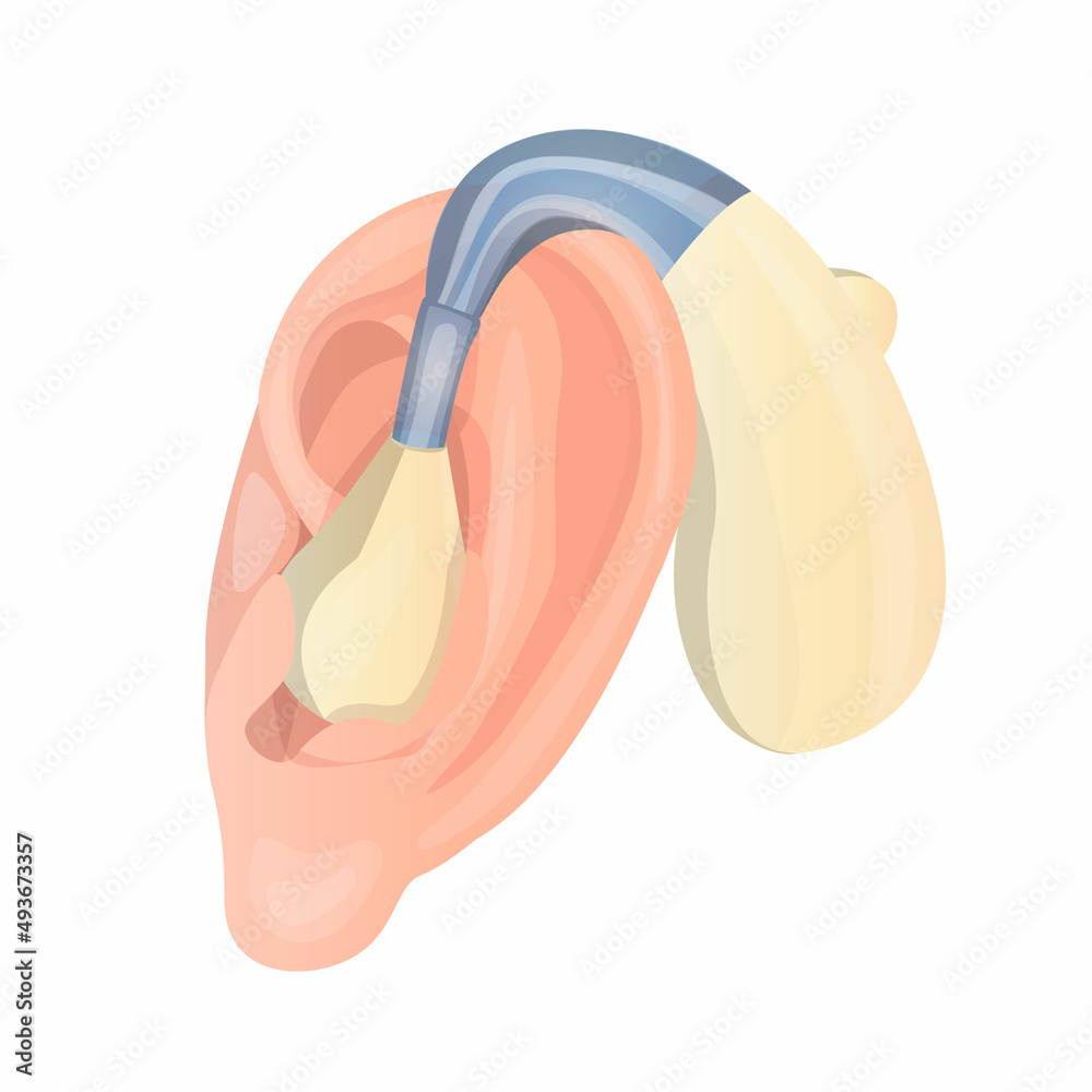 Vector isolated illustration with a human ear and a hearing aid ...