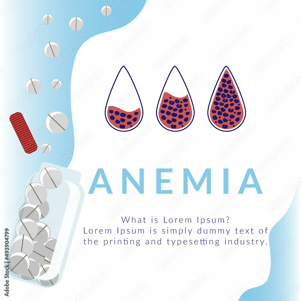 A concept on the topic of anemia. The difference Anemia number of red ...