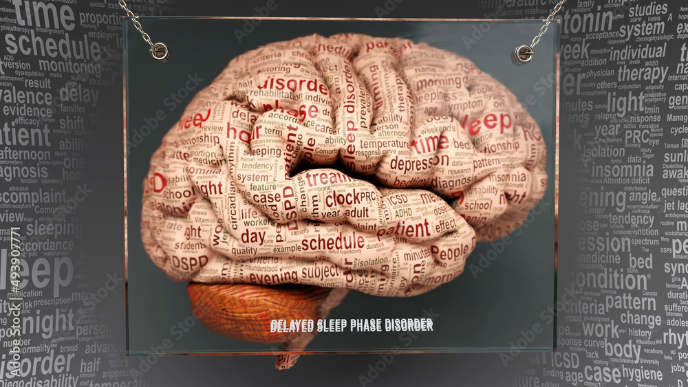 Delayed sleep phase disorder anatomy - its causes and effects projected ...