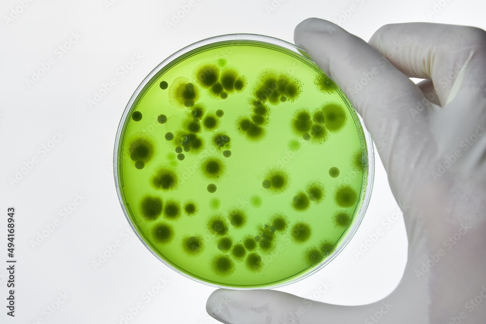 Hand with Petri dish or culture media with bacteria on white background ...