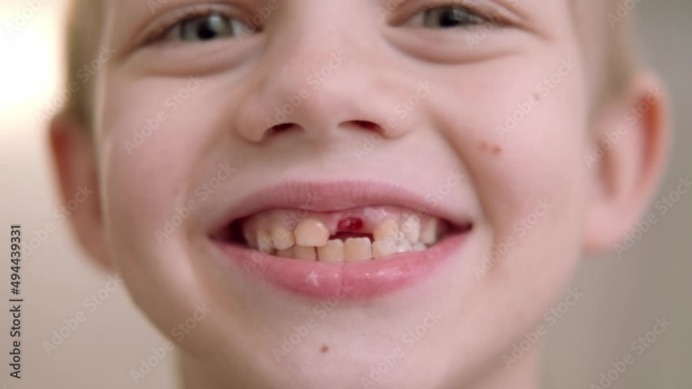 Toothless smile Blonde caucasian baby boy without milk tooth in mouth ...