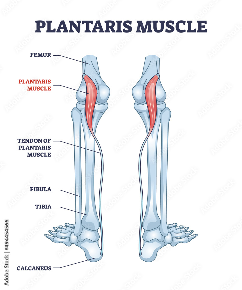 Plantaris muscle as leg superficial posterior compartment part outline ...