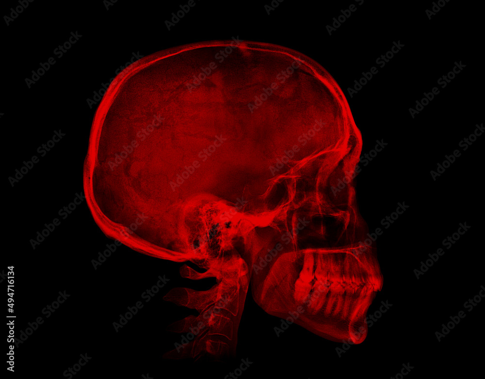 Human skull. Red X-ray image on black background Stock Illustration ...