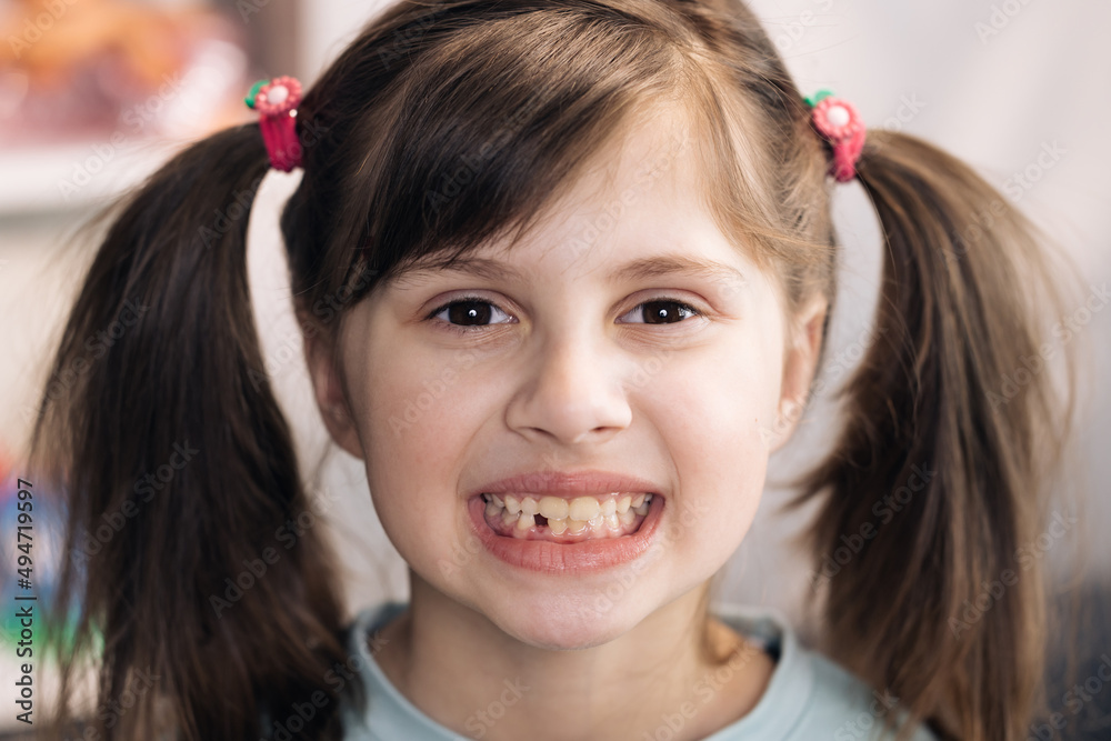 Little girl with tooth first milk temporary tooth. Dental medicine or ...