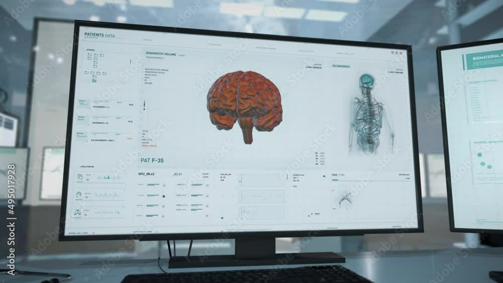 Patient Upper Body Data Scan Via Futuristic Medical Anatomy Mri ...
