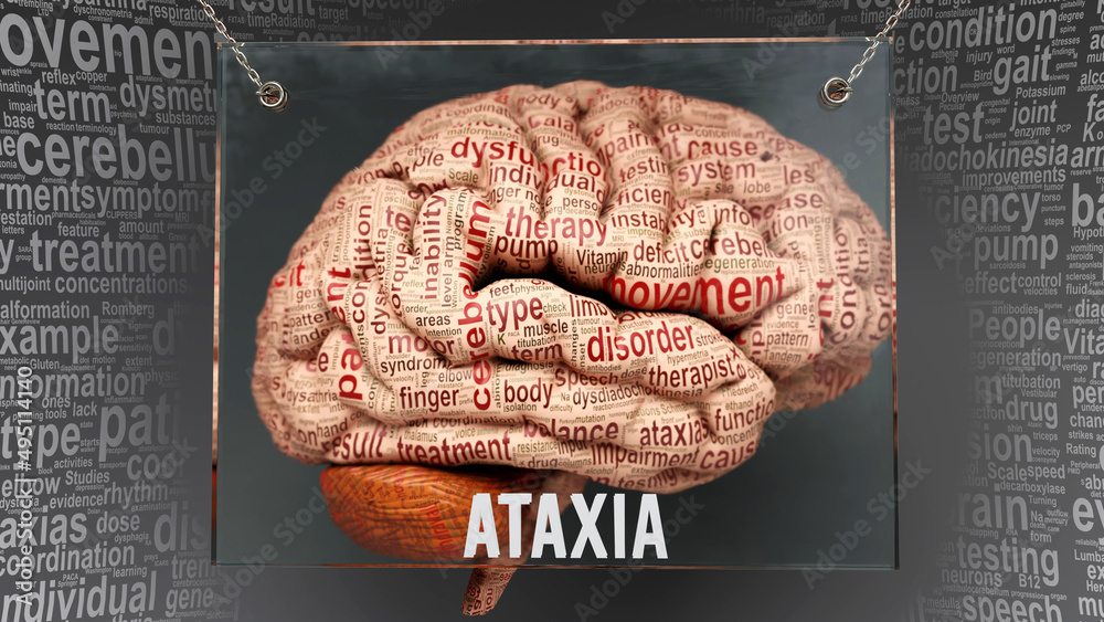 Ataxia anatomy - its causes and effects projected on a human brain ...