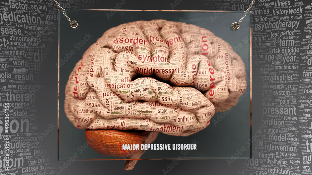 Major depressive disorder anatomy - its causes and effects projected on ...