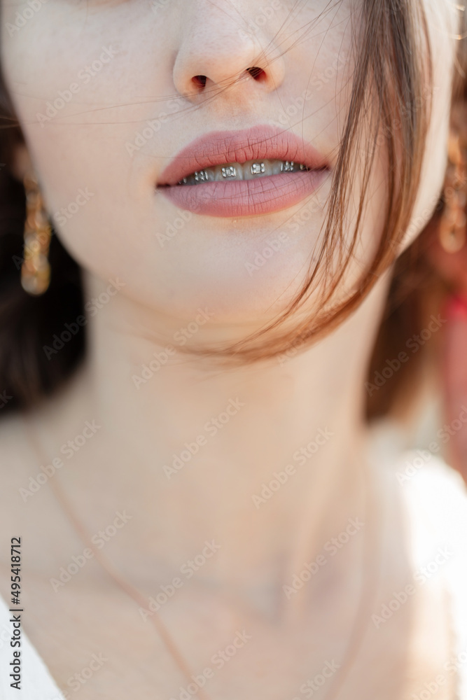 Sexy lips. Natural lip gloss, feminine skin and dental braces. Mouth ...