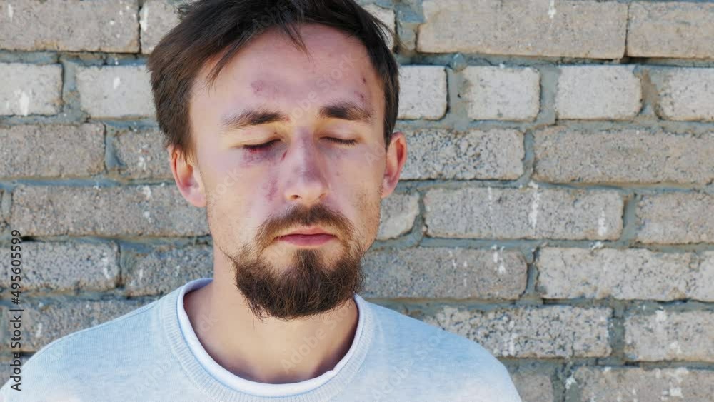 Portrait of european sad man with bruises and cuts on his face. Beaten ...