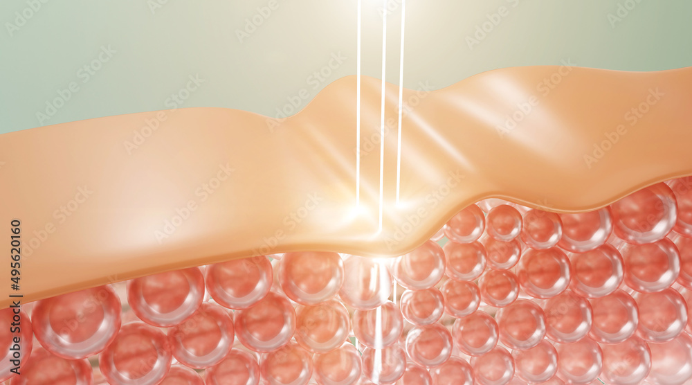 laser or serum vitamin through the skin layer for repair wrinkles and ...