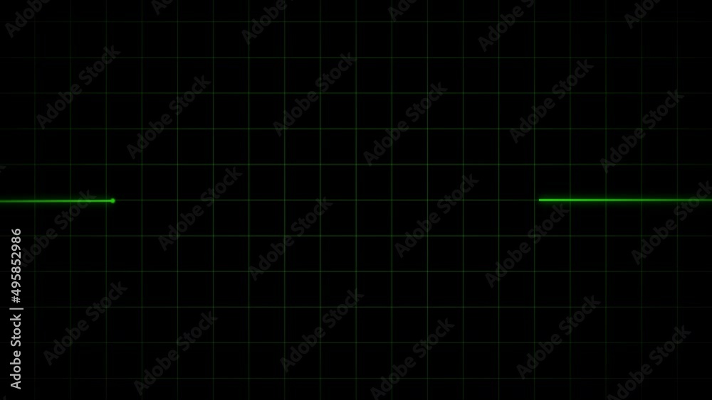 Heartbeat ECG Animation, electrocardiogram heart pulse graph line beat ...
