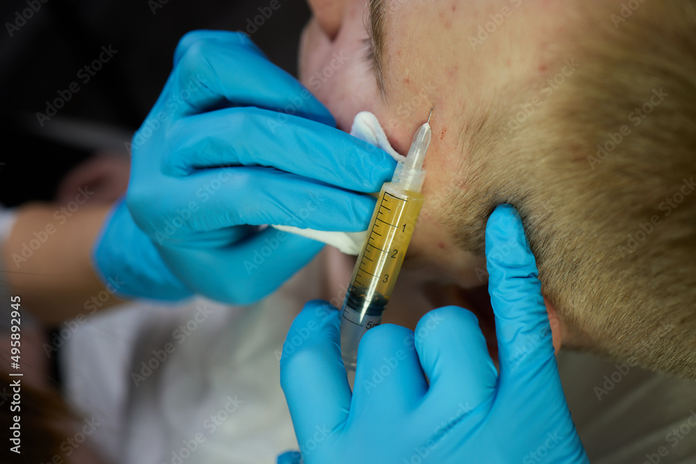 Injection at spa salon. Doctor hands in gloves. Closeup. Pretty male ...