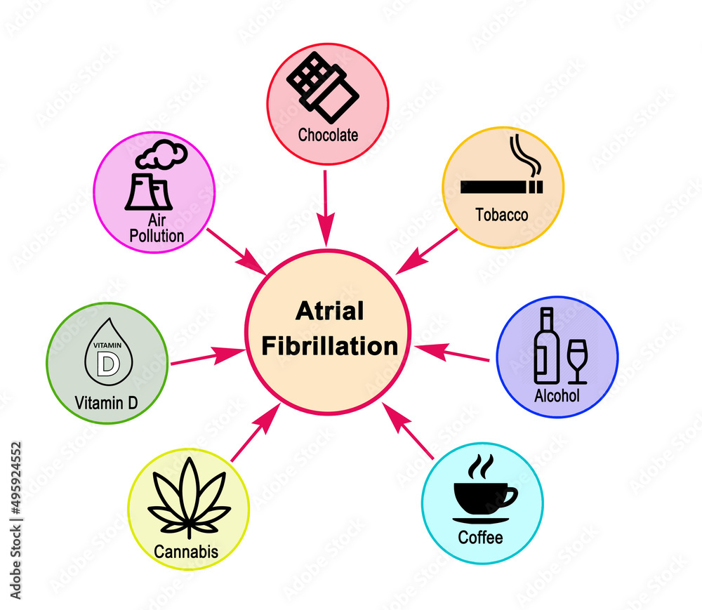 Seven Causes of Atrial Fibrillation Stock Illustration | Adobe Stock
