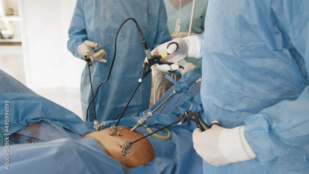 Endoscopy. Close-up. Surgeons' hands with the help of endoscopic ...