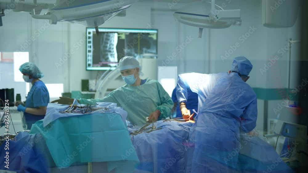 Vidéo Stock Surgical team working on neurosurgery operation. Looking at ...