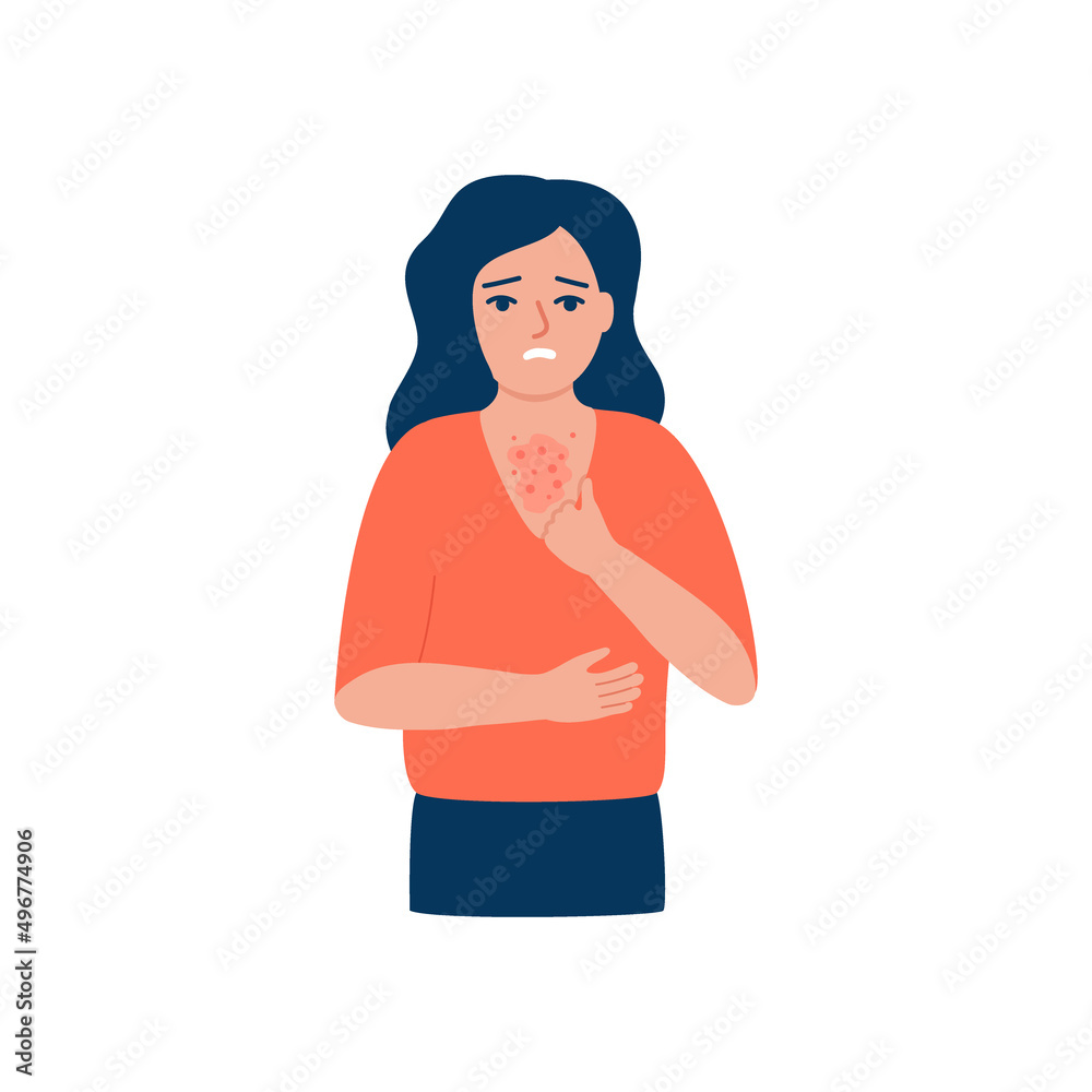 Woman scratching body, rash, allergy, acne on skin. Girl suffering from ...