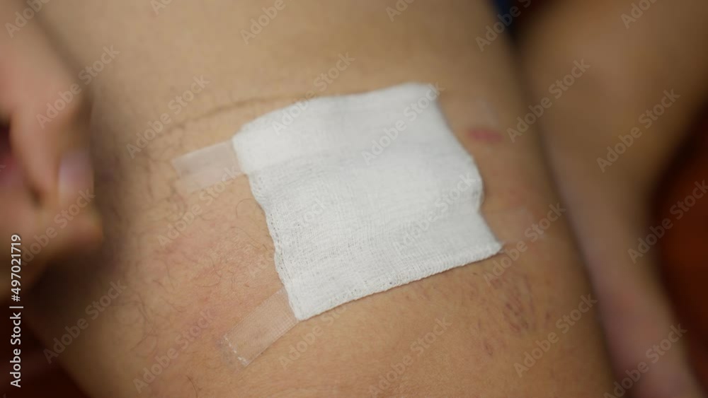 Health care concept. Pain, Wound, cleaning wound, Local people cleaning ...