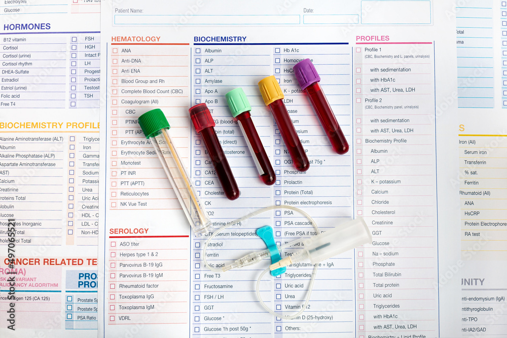 Workplace of laboratory with Blood tubes samples and requisition form ...