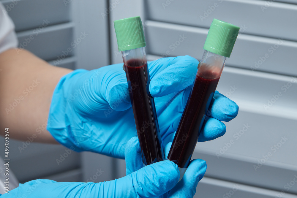 Beautician doctor's hands put test tube with blood in centrifuge ...