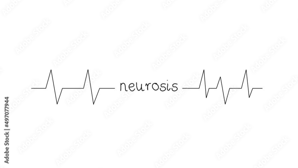 Self Drawing animation A black line of a healthy heart rate appears ...
