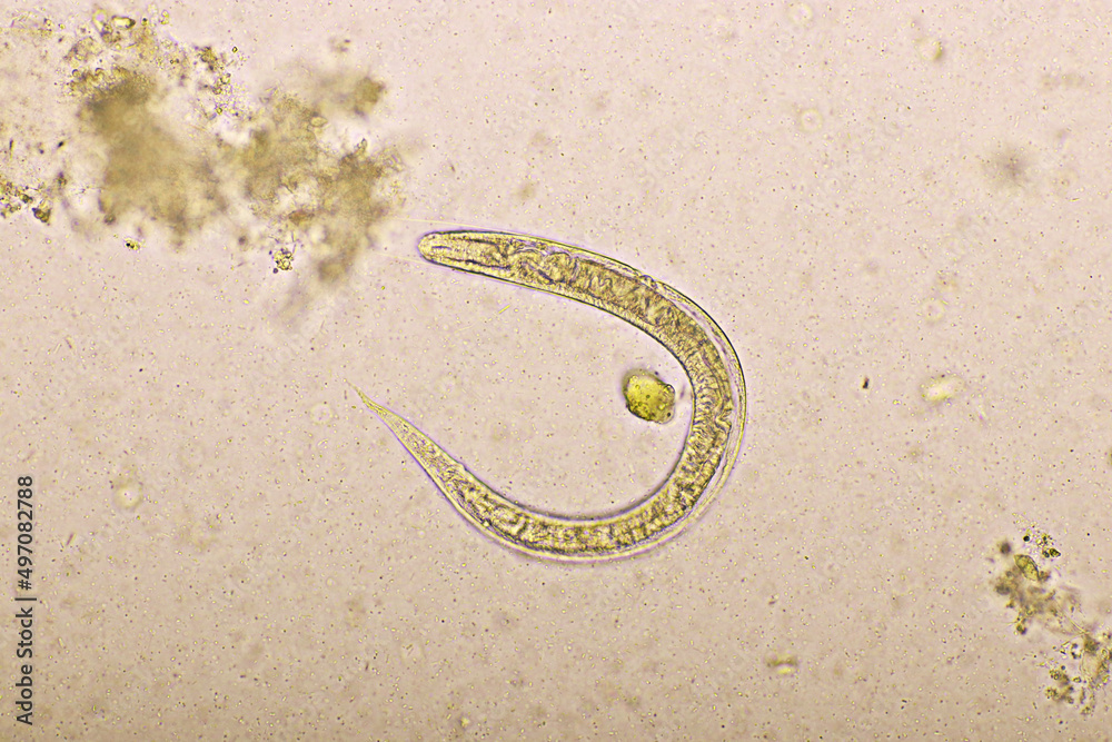 Strongyloides stercoralis or threadworm in human stool, analyze by ...