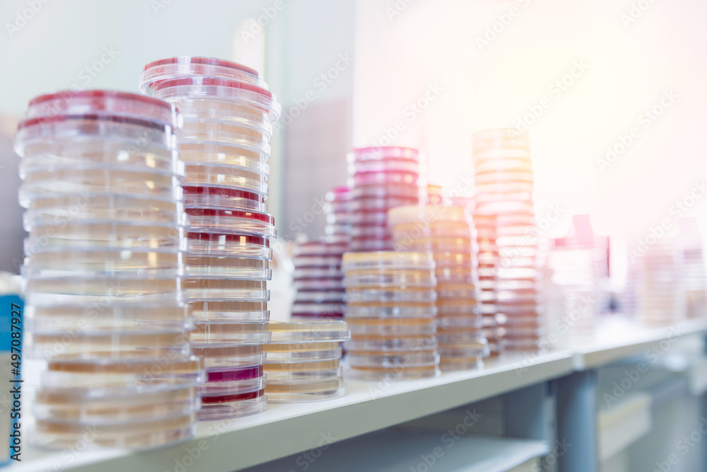 Microbiology concept, hand of medical worker on agar plate culture ...