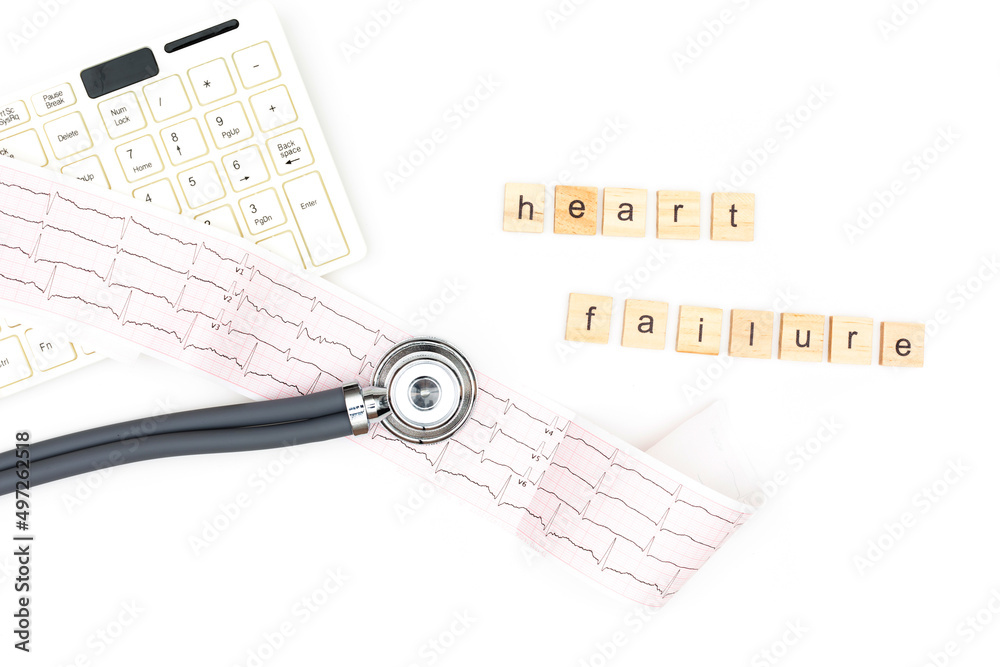 Heart failure. Flatlay arrangement. Stethoscope with electrocardiogram ...