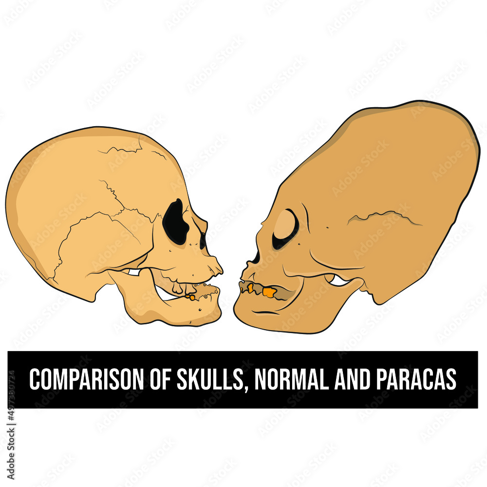 Comparison of Paracas skull and human skull. Paracas Culture - Peru ...