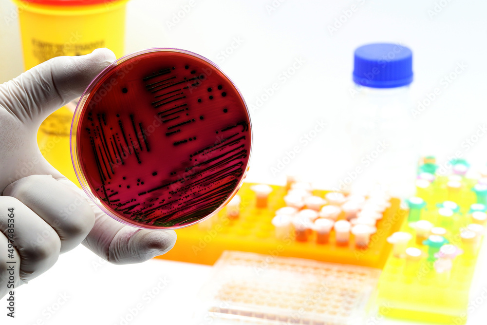 Escherichia coli bacteria growing on a selective medium in the ...