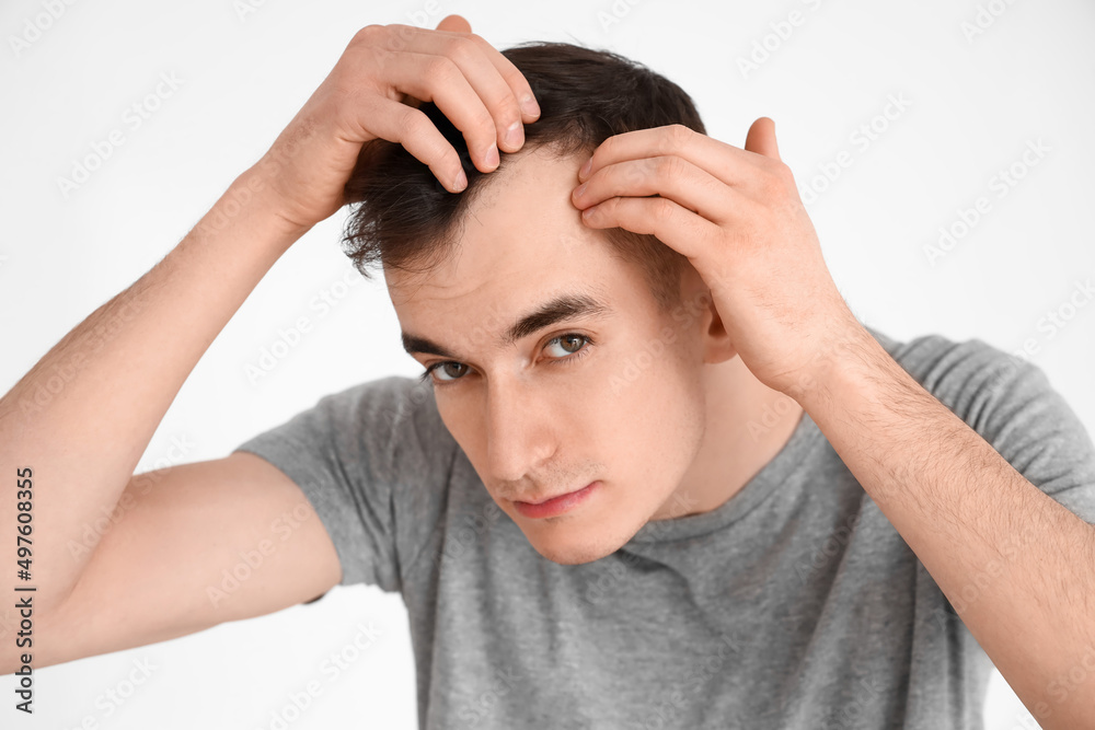 Young brunette man with hair loss problem on white background, closeup ...