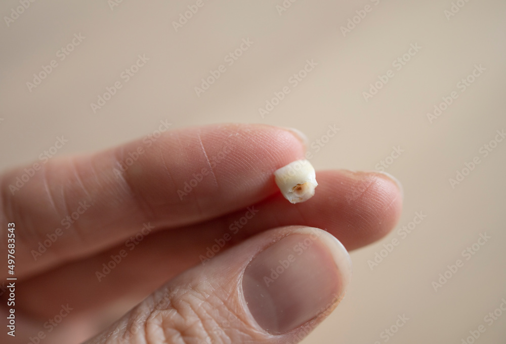 child's tooth in the hands of a woman, on a light background. Health ...