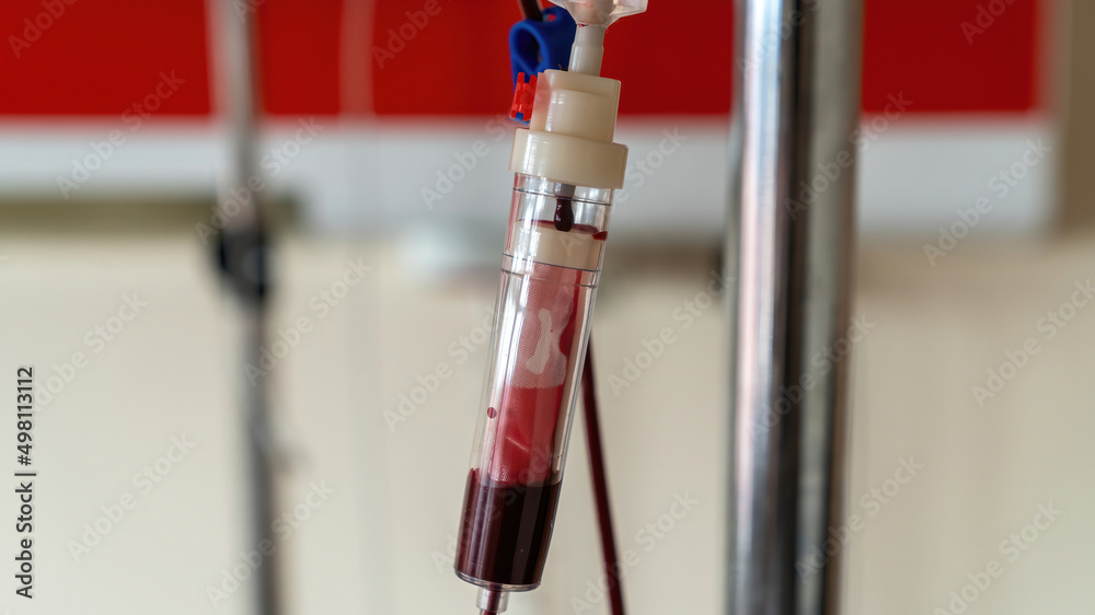 Blood transfusion serum in hospital room with blood drip. Medical ...