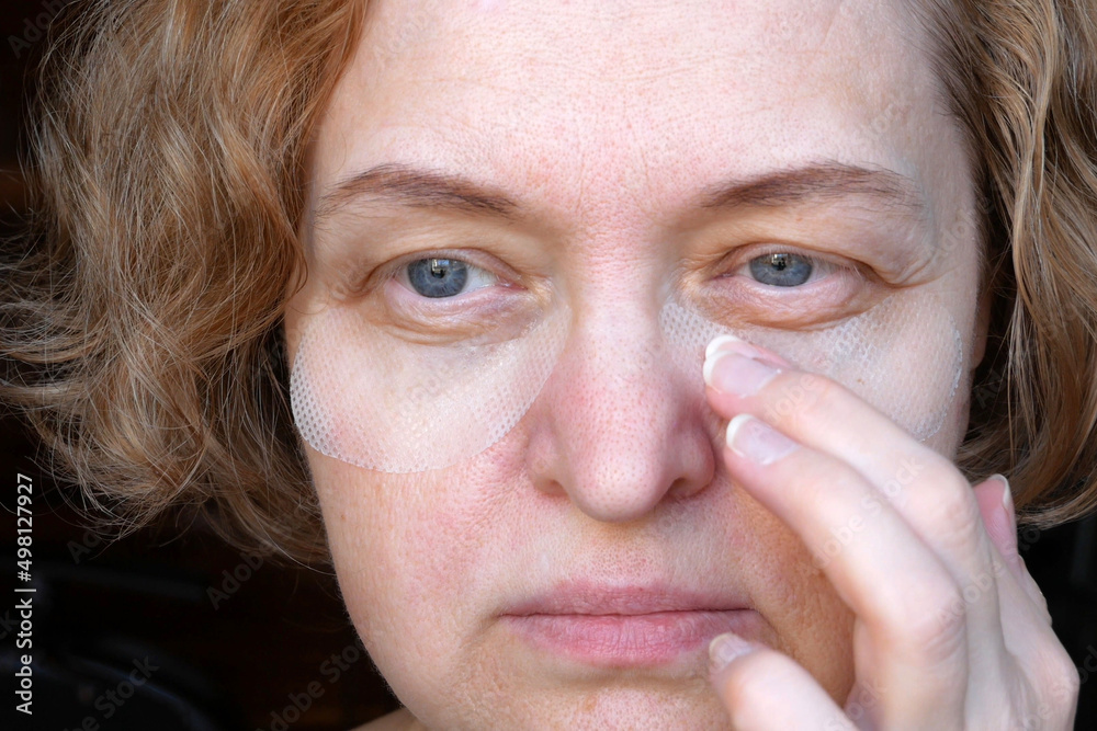 middle aged female's eye with drooping eyelid with patch for eyes ...