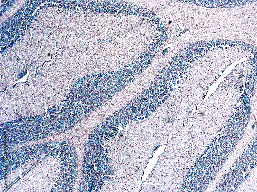 Cross section of a cerebellum. Light micrograph. Cresyl Violet Staining ...