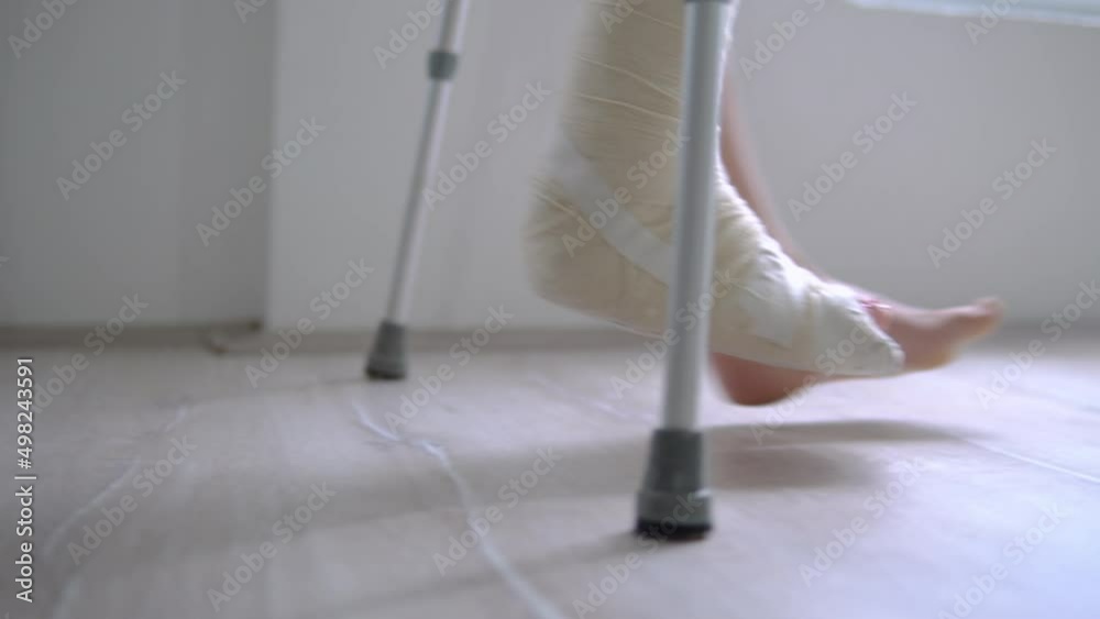 Young woman with broken leg in plaster cast trying to walk with ...