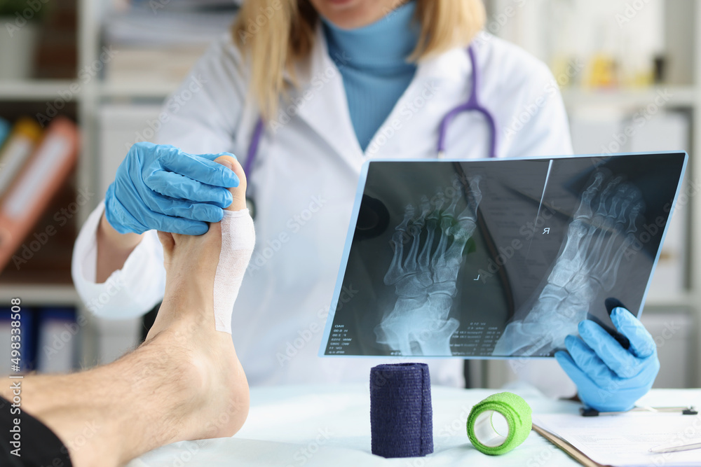 Patient with leg injury at doctor appointment closeup Stock Photo ...