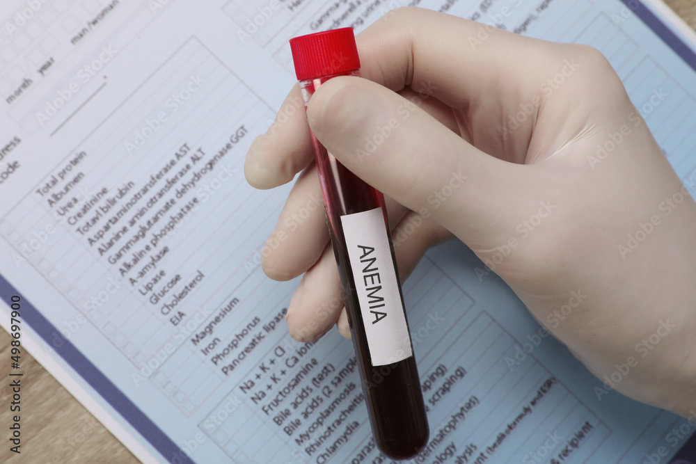 Doctor holding test tube with blood sample and label Anemia over ...