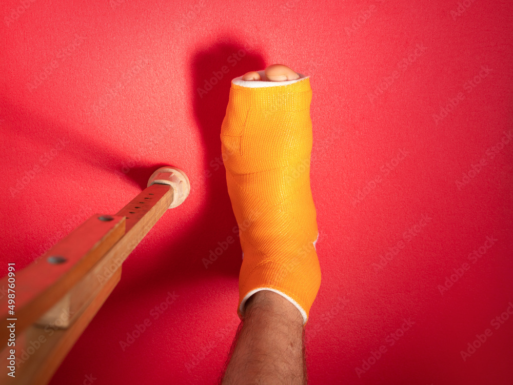 Foot with broken toe bone in orange fiberglass cast pink background ...
