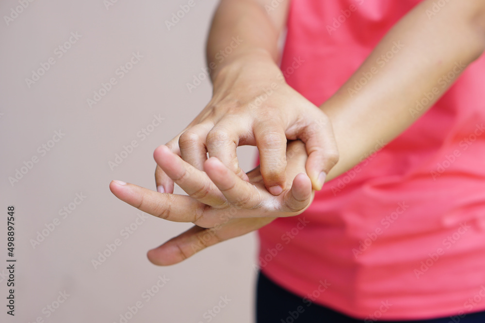 medical, sickness, sick, body, ringworm, suffer, eczema, injury ...