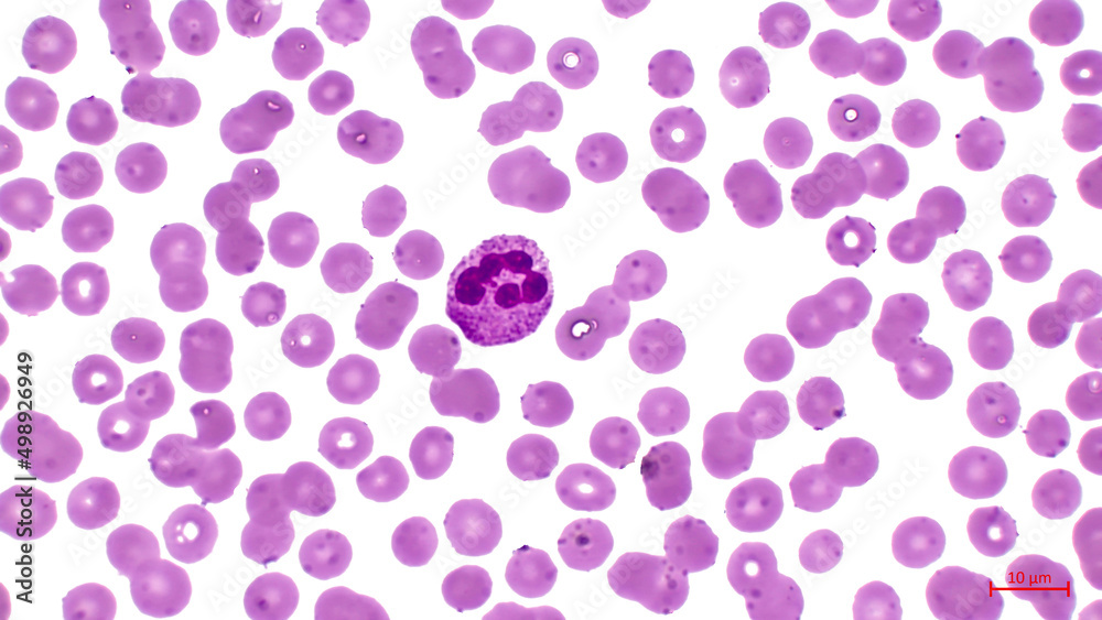 Light micrograph showing human blood cells. Erythrocytes are pink. They ...