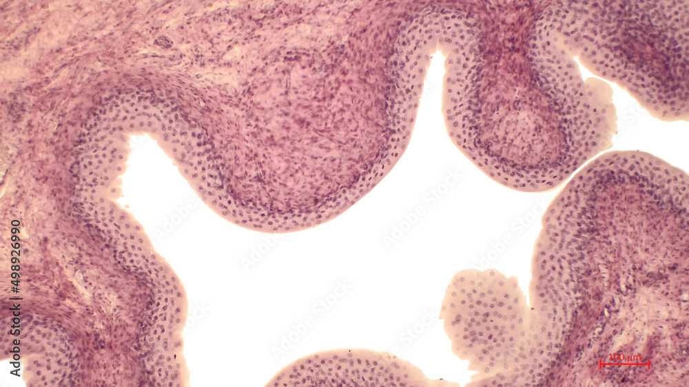 Light microscopy of the internal lining of the urinary bladder. The ...