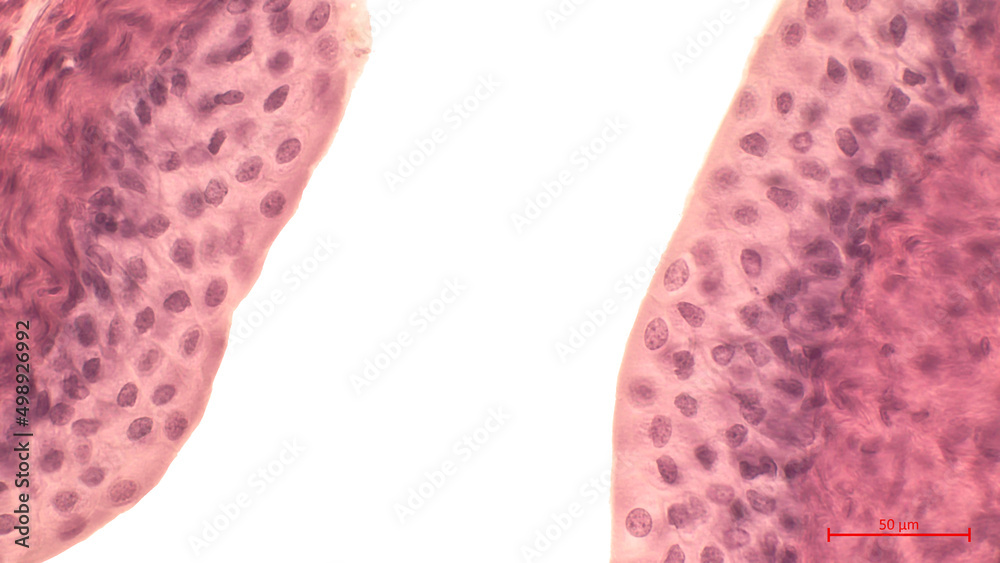 Light microscopy of the internal lining of the urinary bladder. The ...