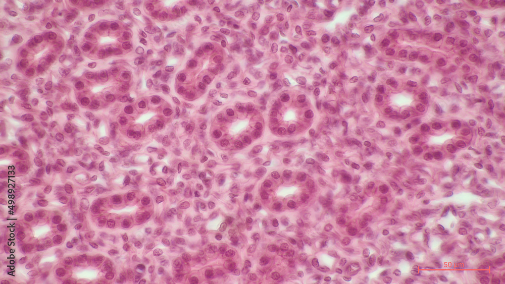 Human kidney tissue, light micrograph. Haematoxylin and eosin stain ...