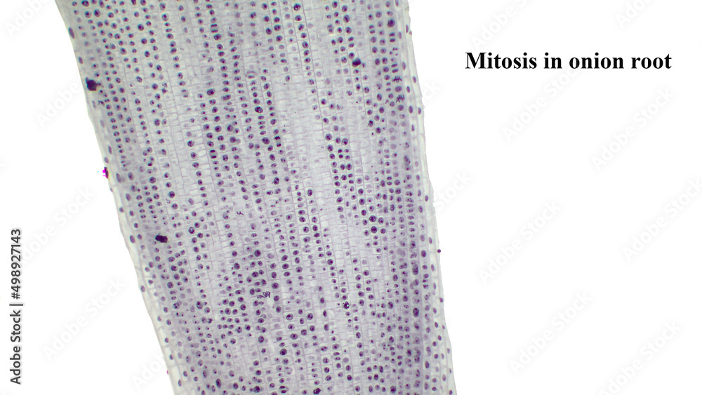 Light photomicrograph of Mitosis in onion root tip cells seen through ...