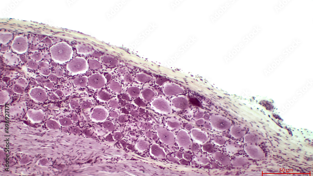 Spinal nerve ganglion. Light micrograph of a section through a spinal ...