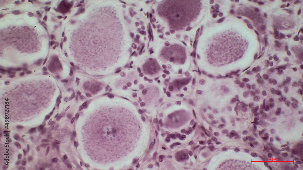 Foto de Spinal nerve ganglion. Light micrograph of a section through a ...