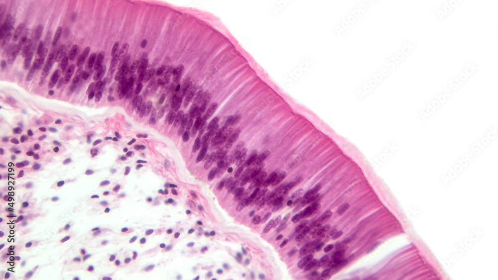 Ciliated Pseudostratified Columnar Epithelium
