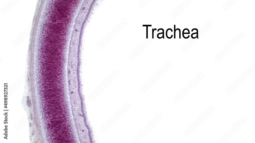 Light micrograph of a section through the trachea, or windpipe, the ...